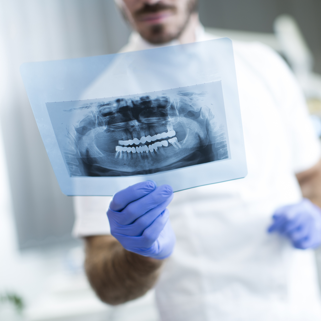 Documenti - Tooth Transformer system